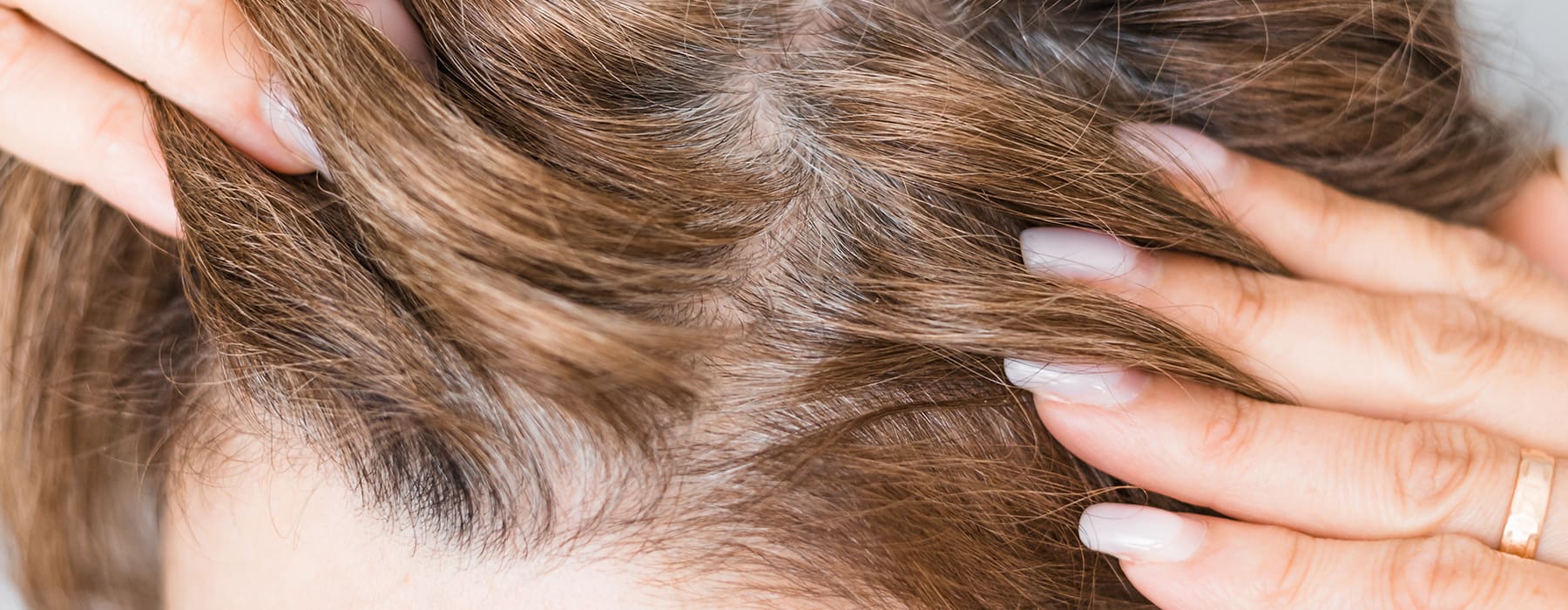 PRF Hair Restoration vs. Other Hair Loss Treatments